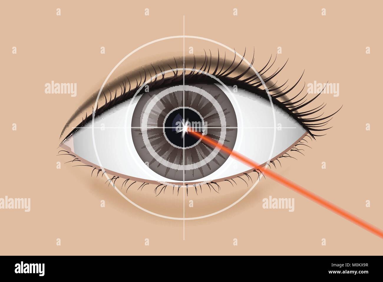 Laser Eye Surgery High Resolution Stock Photography and Images - Alamy