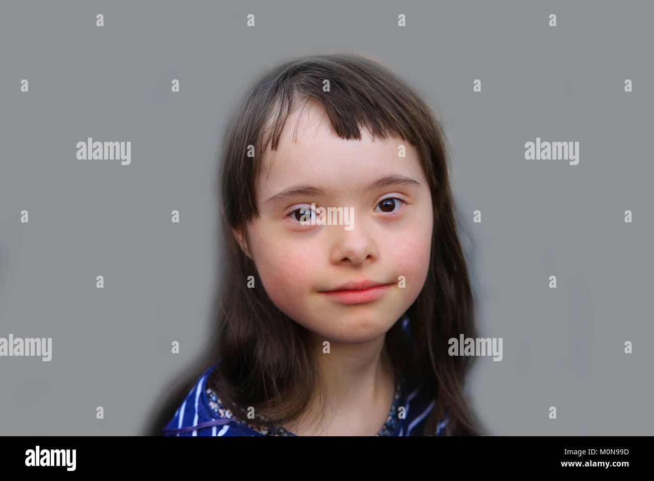 Cute down syndrome girl on the grey background Stock Photo - Alamy