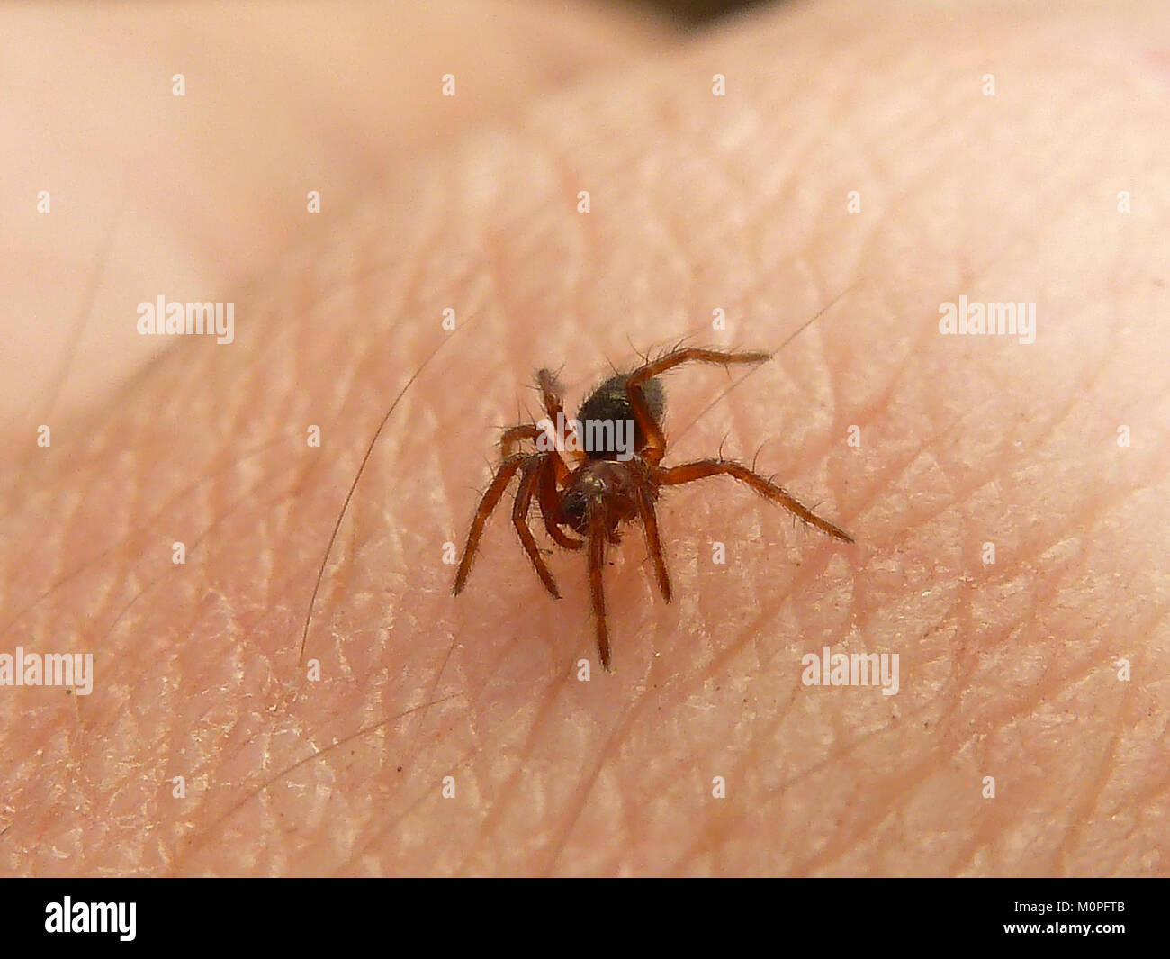 Spider bites hi-res stock photography and images - Alamy