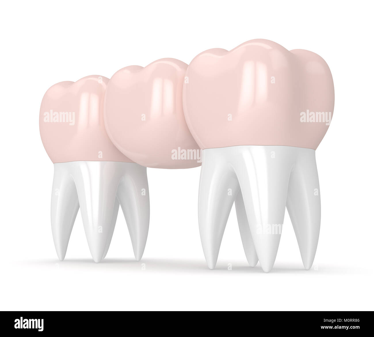 3d render of dental bridge with dental crowns isolated over white ...