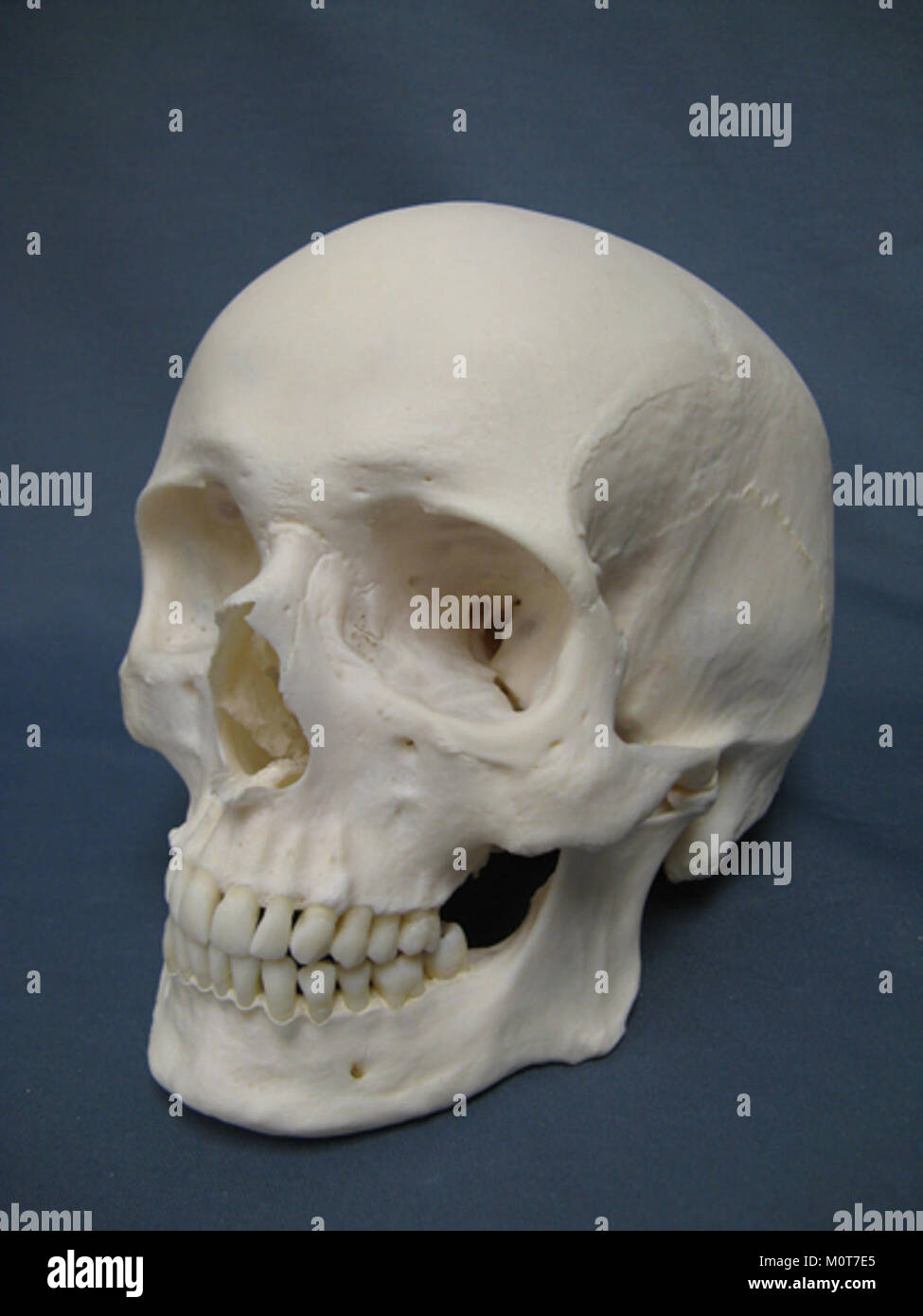 This image shows a Caucasian human skull, an important artifact for ...