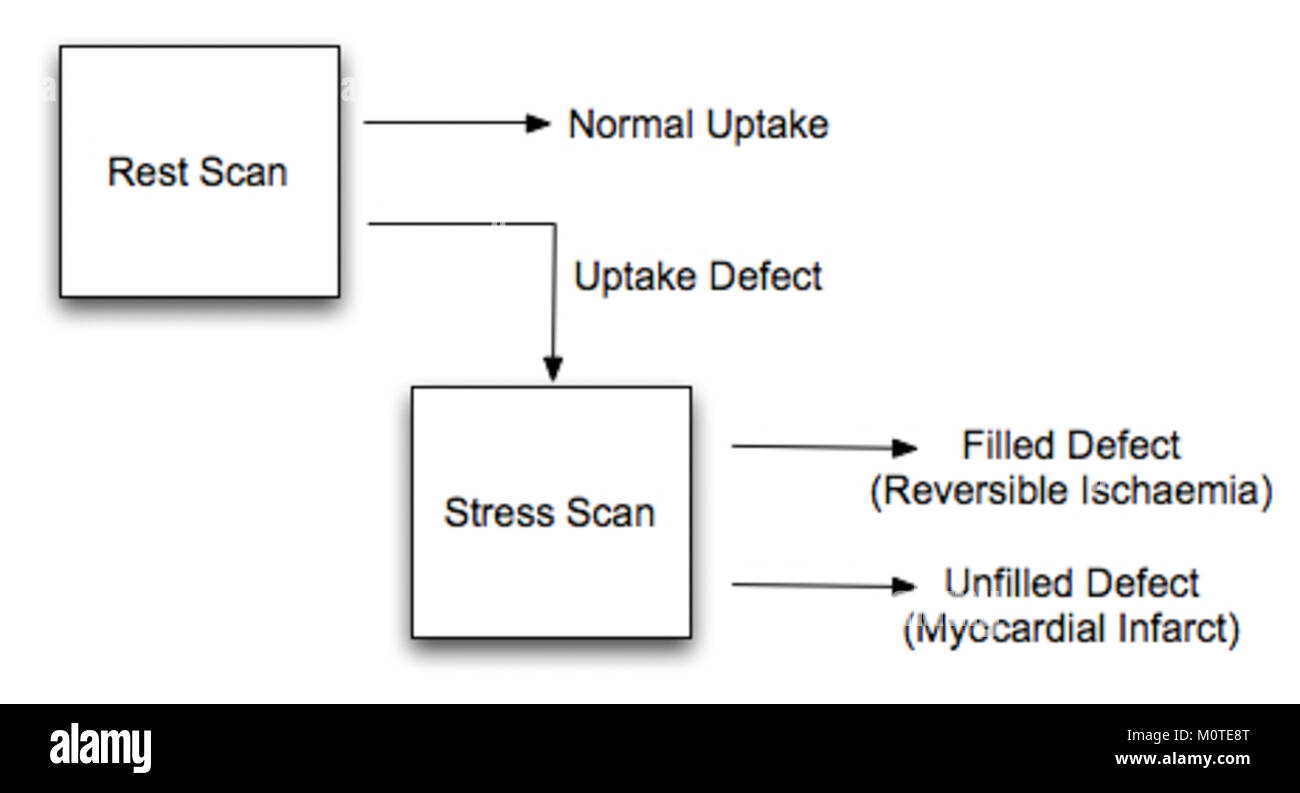 A cardiac stress test is a medical procedure used to assess the heart's ...