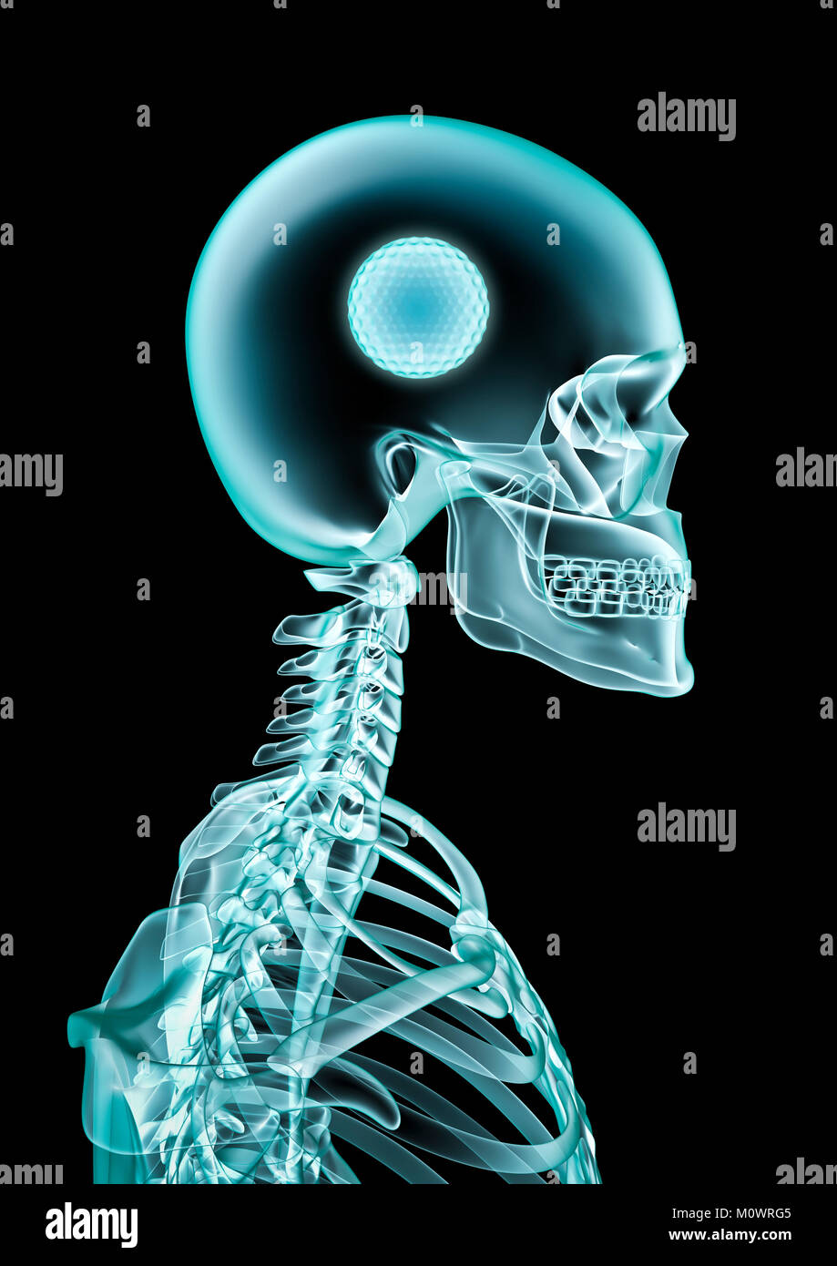 X-ray golf fan / 3D illustration of skeleton x-ray showing golf ball ...