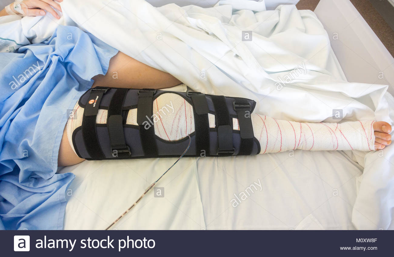 Immobilizer Stock Photos & Immobilizer Stock Images - Alamy