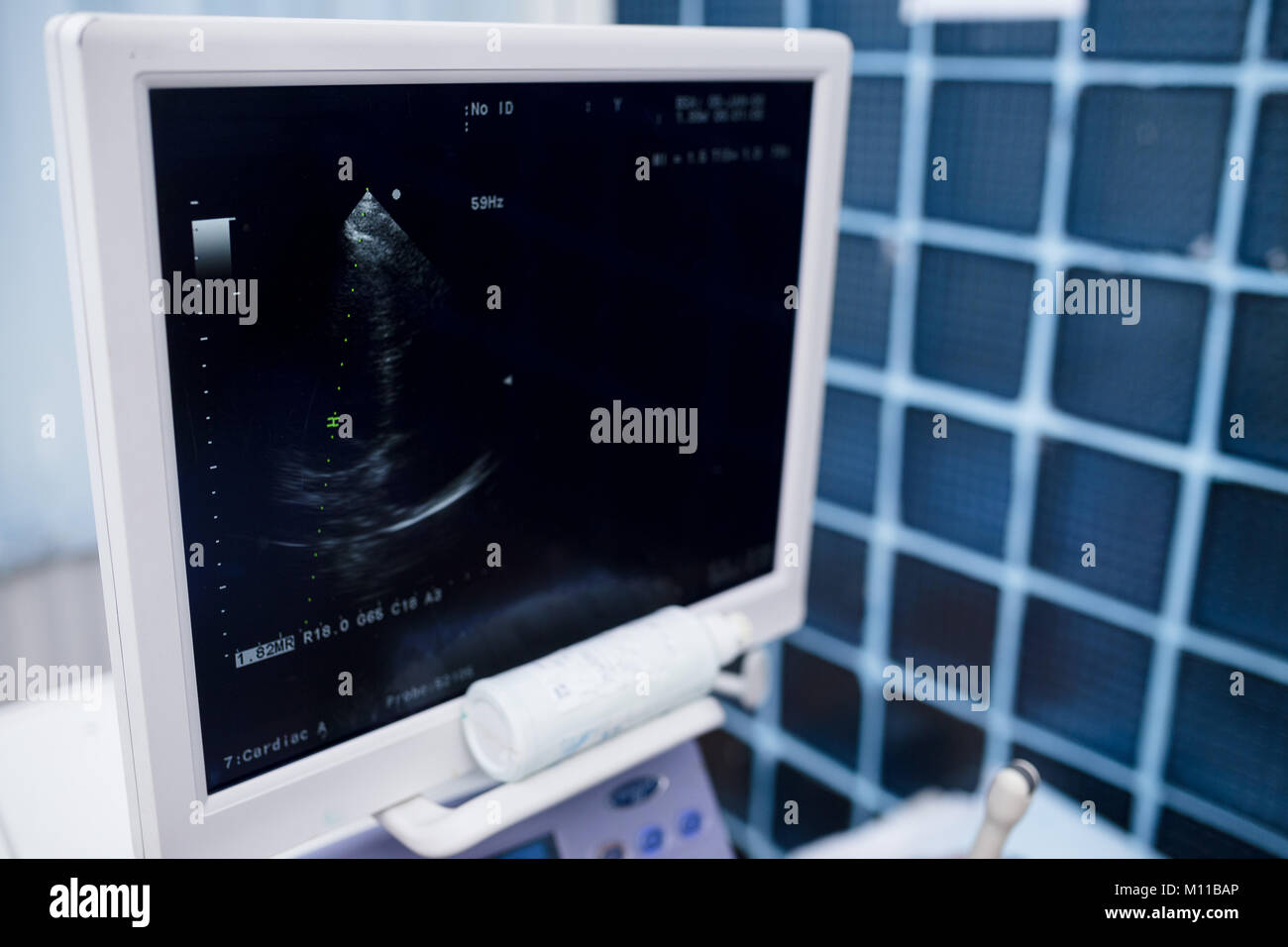 medical equipment, close up ultrasound machine, monitor, ultrasound ...