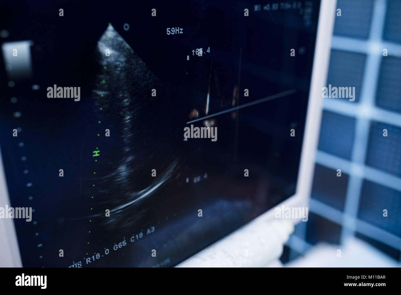 medical equipment, close up ultrasound machine, monitor, ultrasound ...