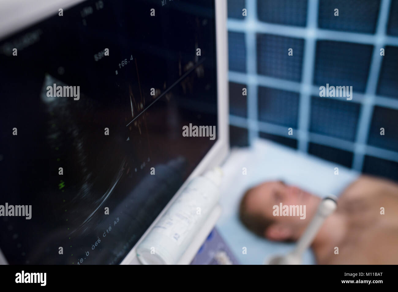 medical equipment, close up ultrasound machine, monitor, ultrasound ...