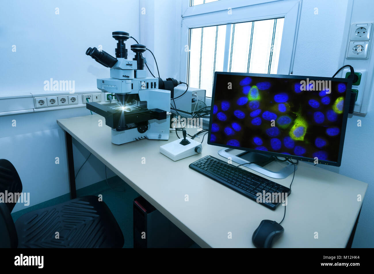 Modern microscope station with cell stained with antibody on the screen ...