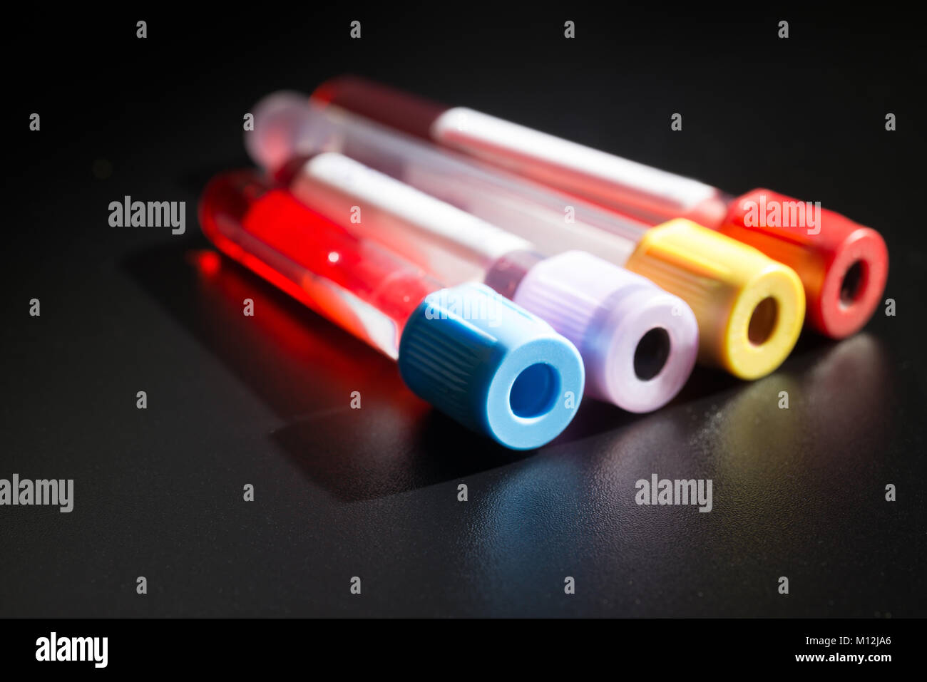 Test tube blood clot hi-res stock photography and images - Alamy