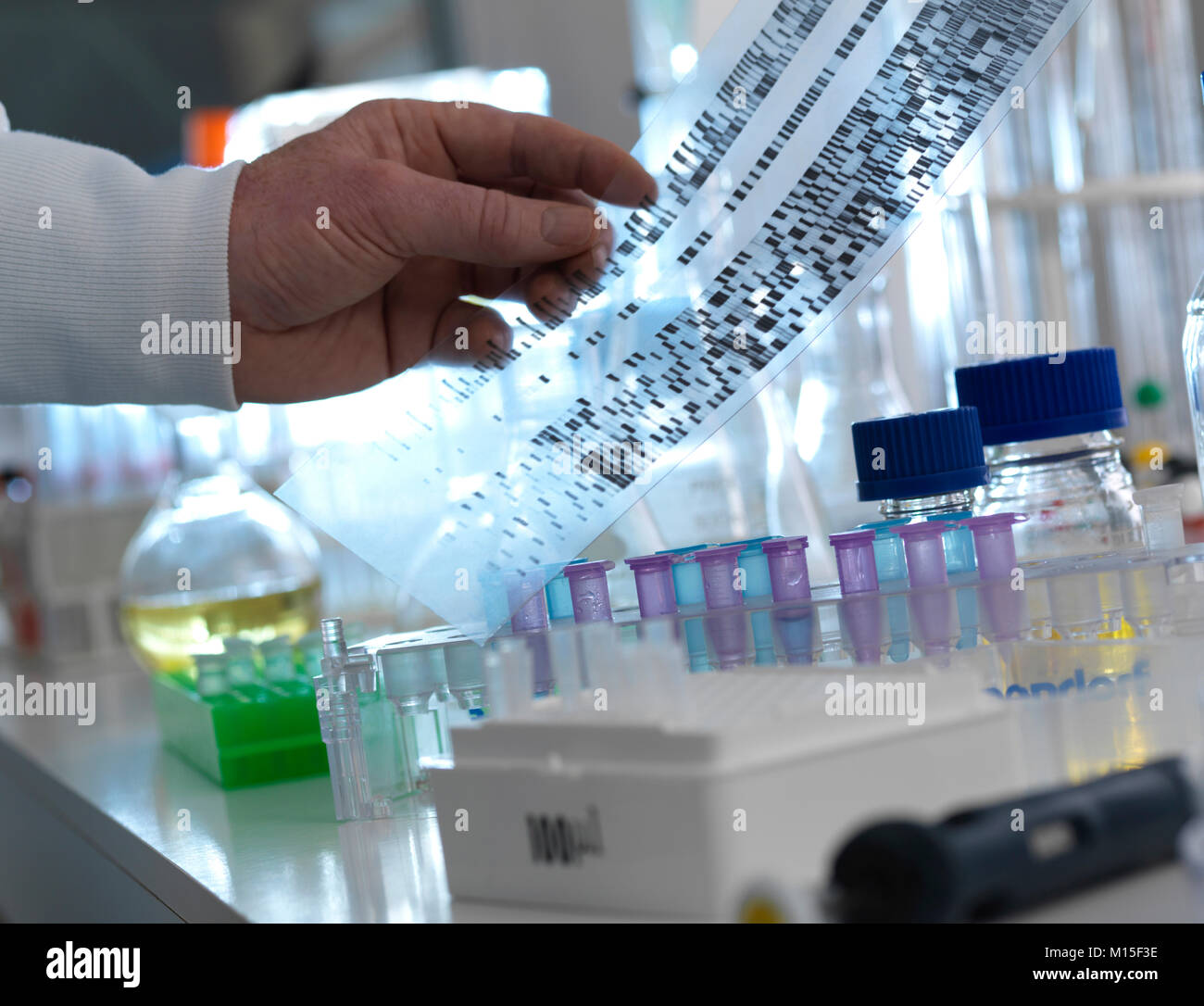 Human dna autoradiogram hi-res stock photography and images - Alamy