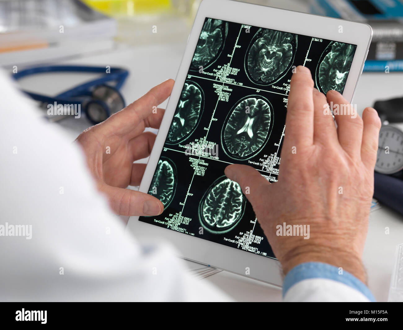 MODEL RELEASED. Doctor viewing brain scans on a digital tablet Stock ...