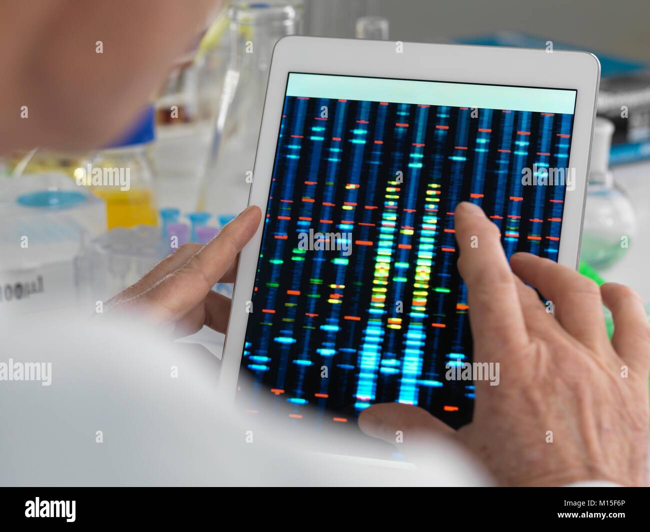 Dna Fingerprinting Machine