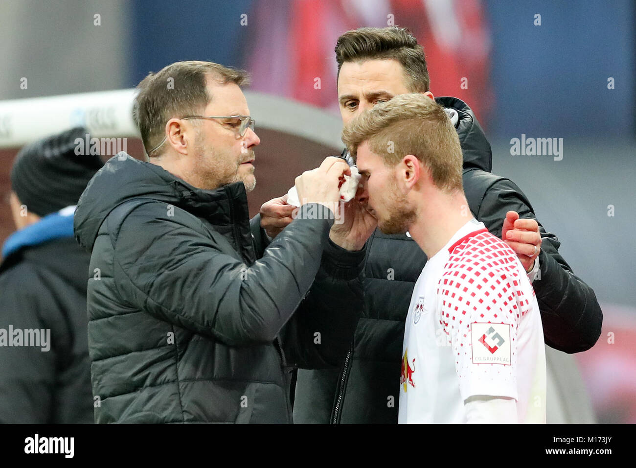 Leipzig's Timo Werner receives treatment after an injury to his nose ...