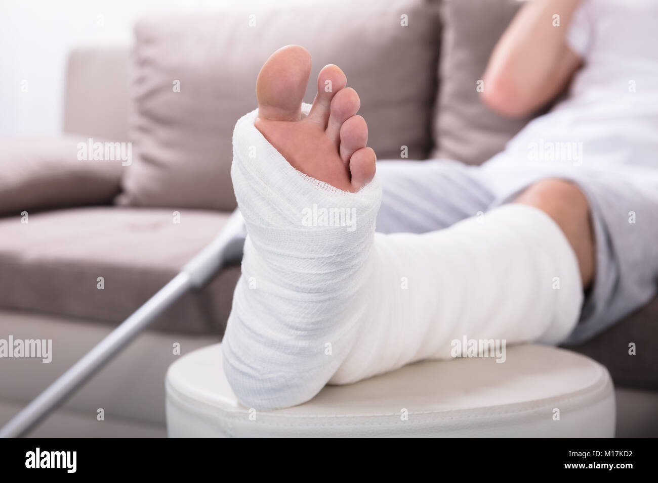 Close-up Photo Of A Man's Plastered Leg Stock Photo - Alamy