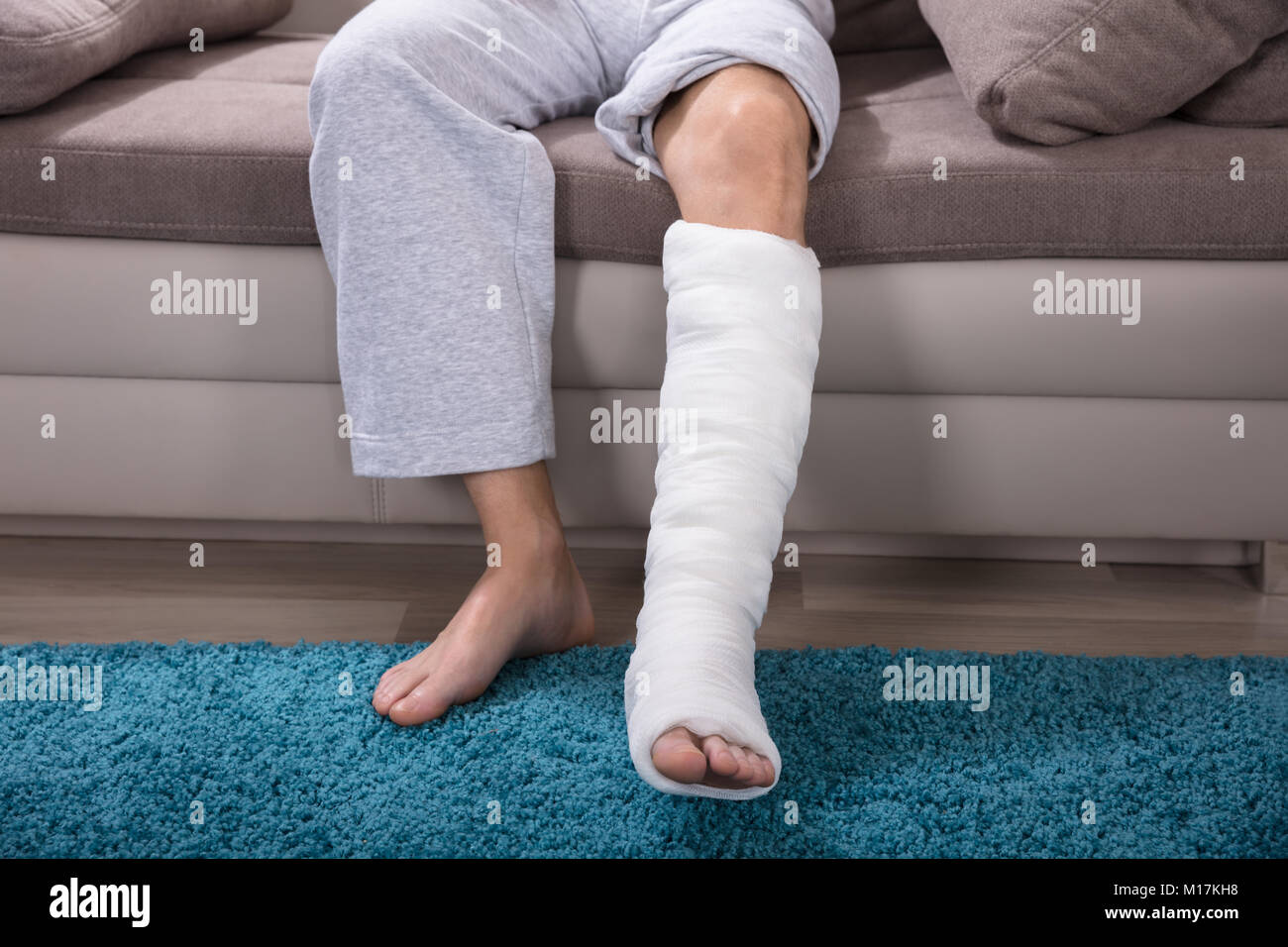 Low Section View Of A Man's Plastered Leg On Carpet Stock Photo - Alamy