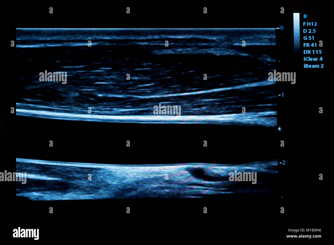 Colourful image of modern ultrasound monitor. Ultrasonography machine ...