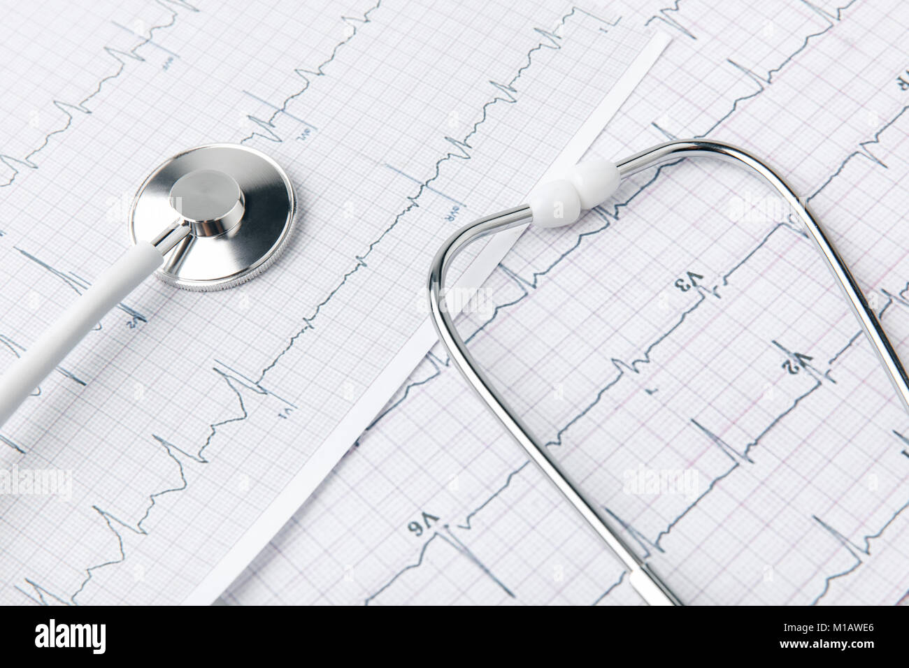 stethoscope laying on paper with cardiogram isolated on white ...