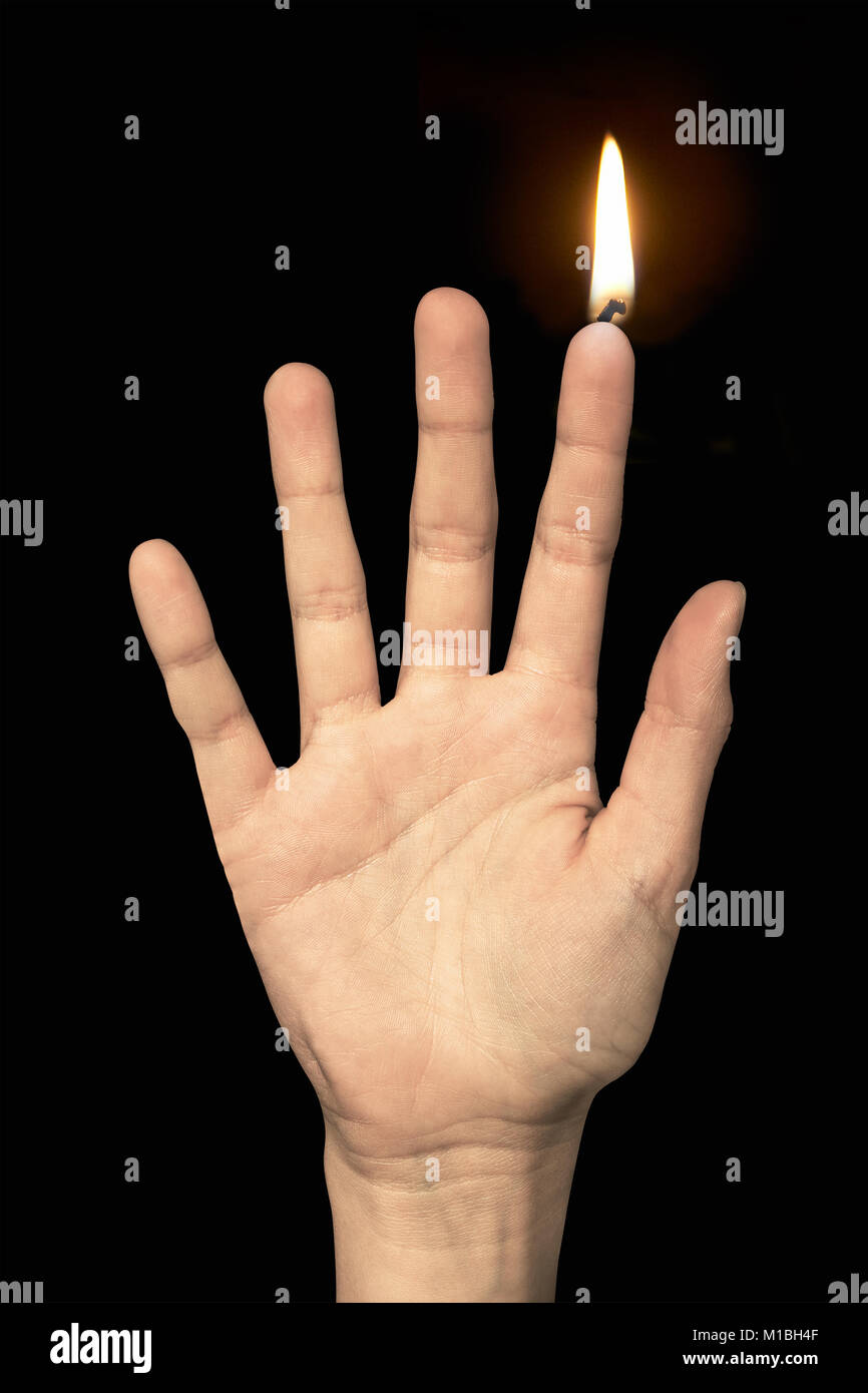 Burn finger hi-res stock photography and images - Alamy