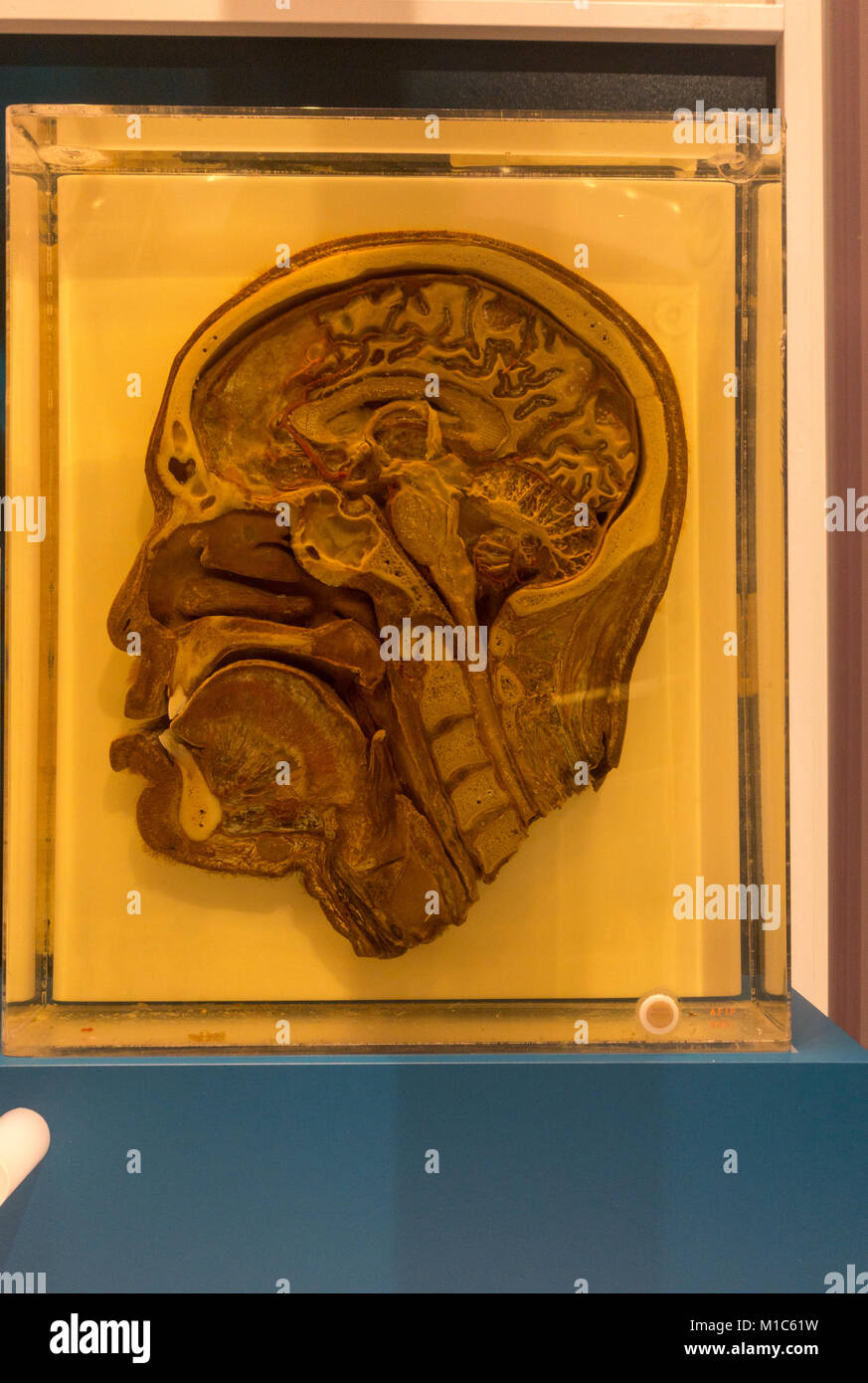 Skull brain cross section hi-res stock photography and images - Alamy