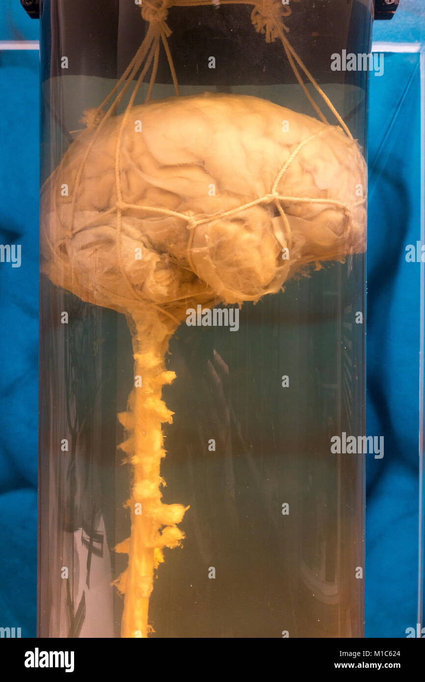 Real Human Brain And Spinal Cord