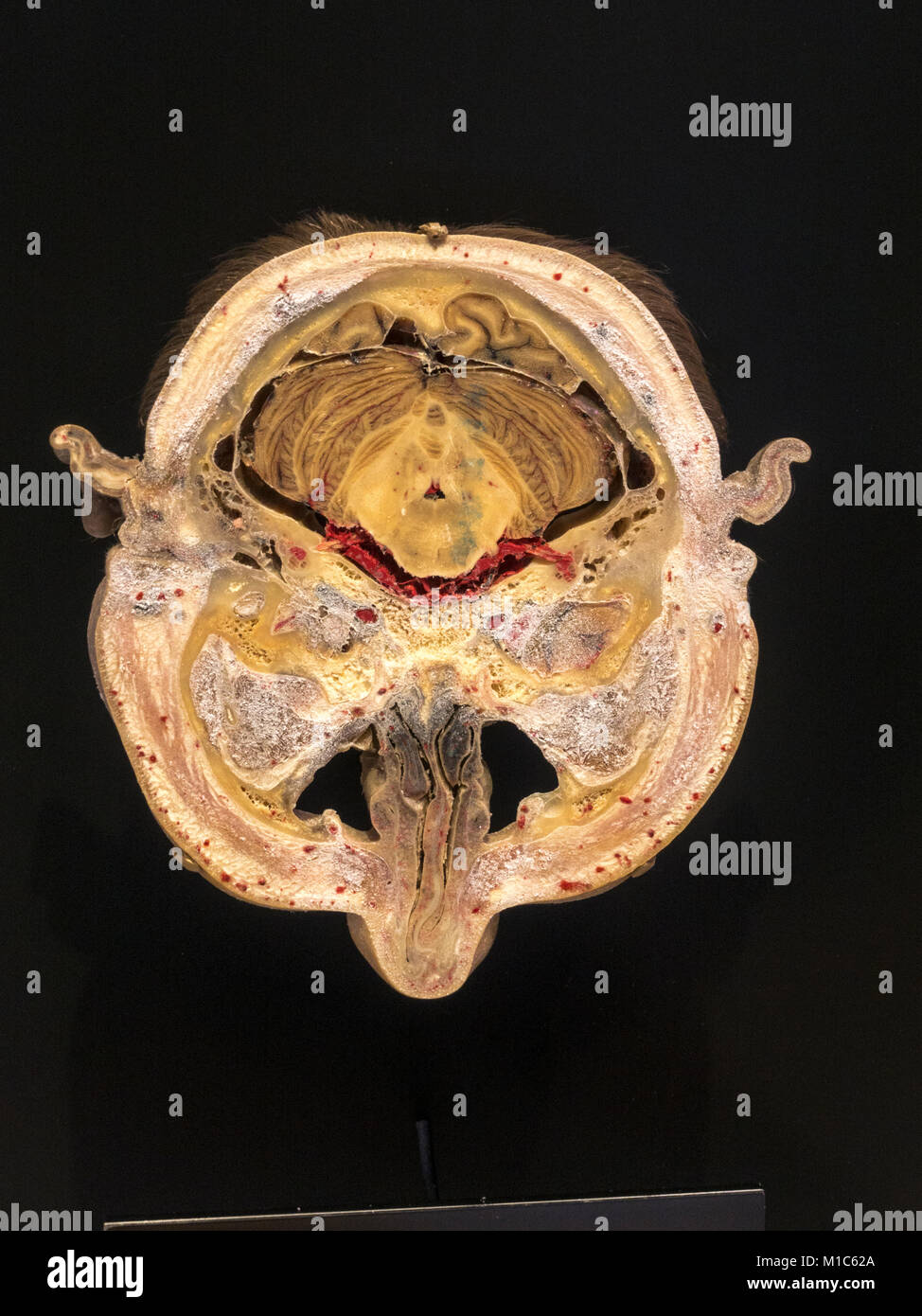 Skull brain cross section hi-res stock photography and images - Alamy