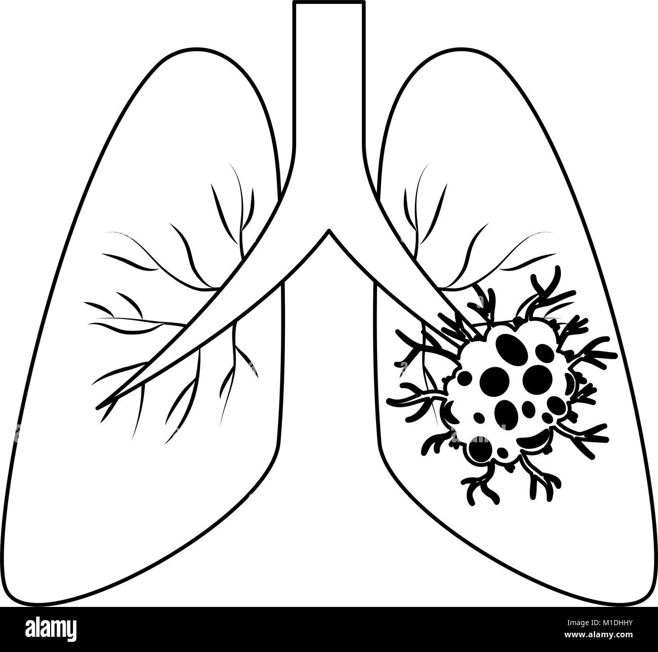 Lung Cancer Isolated Icon Vector Illustration Design Stock Vector Image
