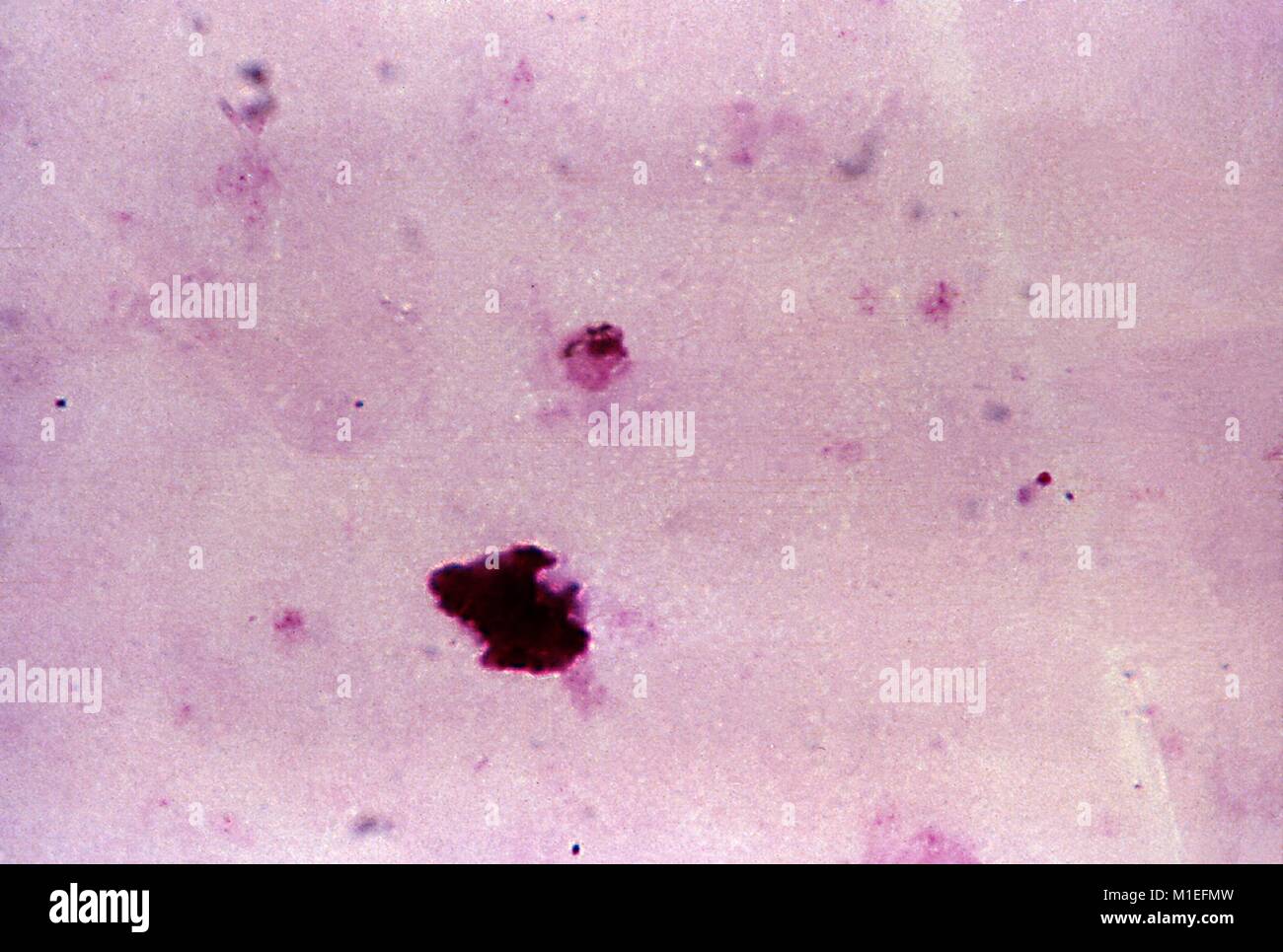 Pigmented cells hi-res stock photography and images - Alamy