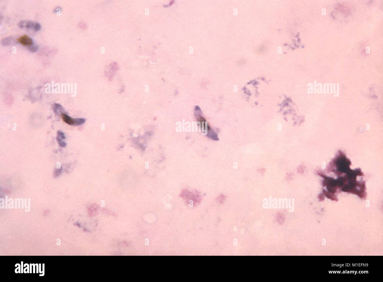 Gametocytes hi-res stock photography and images - Alamy