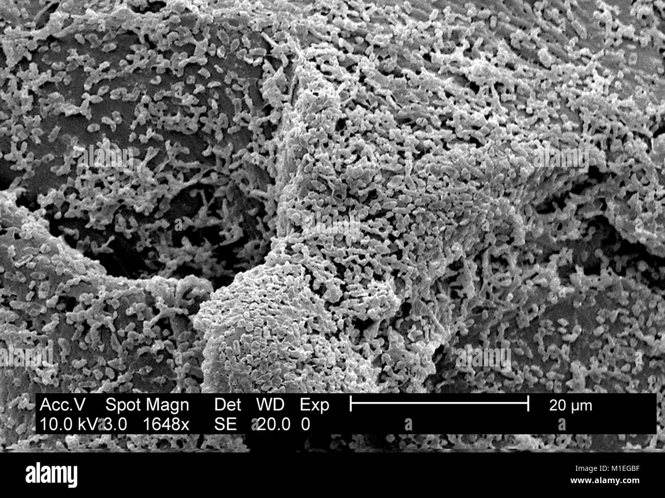 SEM micrograph of P. mirabilis (ATCC 29906) biofilm, colony of the Gram ...