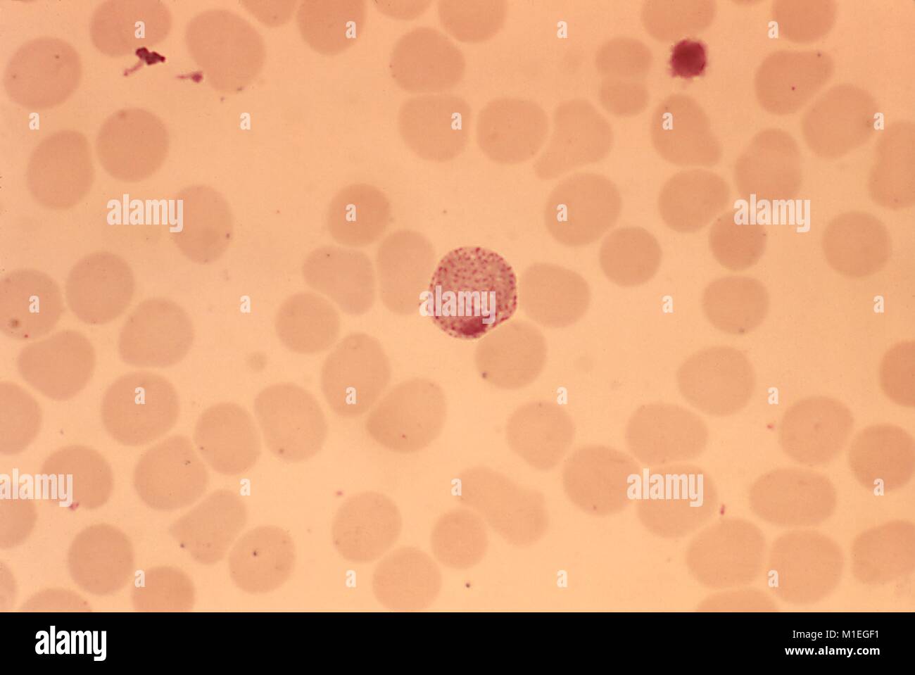 Plasmodium vivax macrogametocyte revealed in a blood smear ...