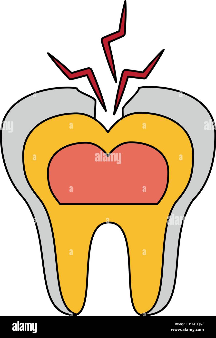 Broken tooth smile Stock Vector Images - Alamy