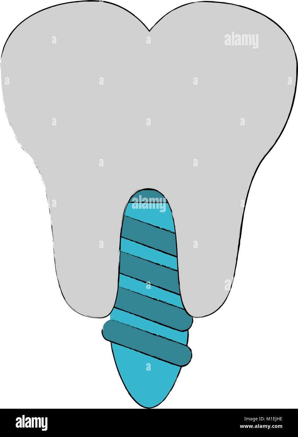 tooth implant symbol Stock Vector Image & Art - Alamy