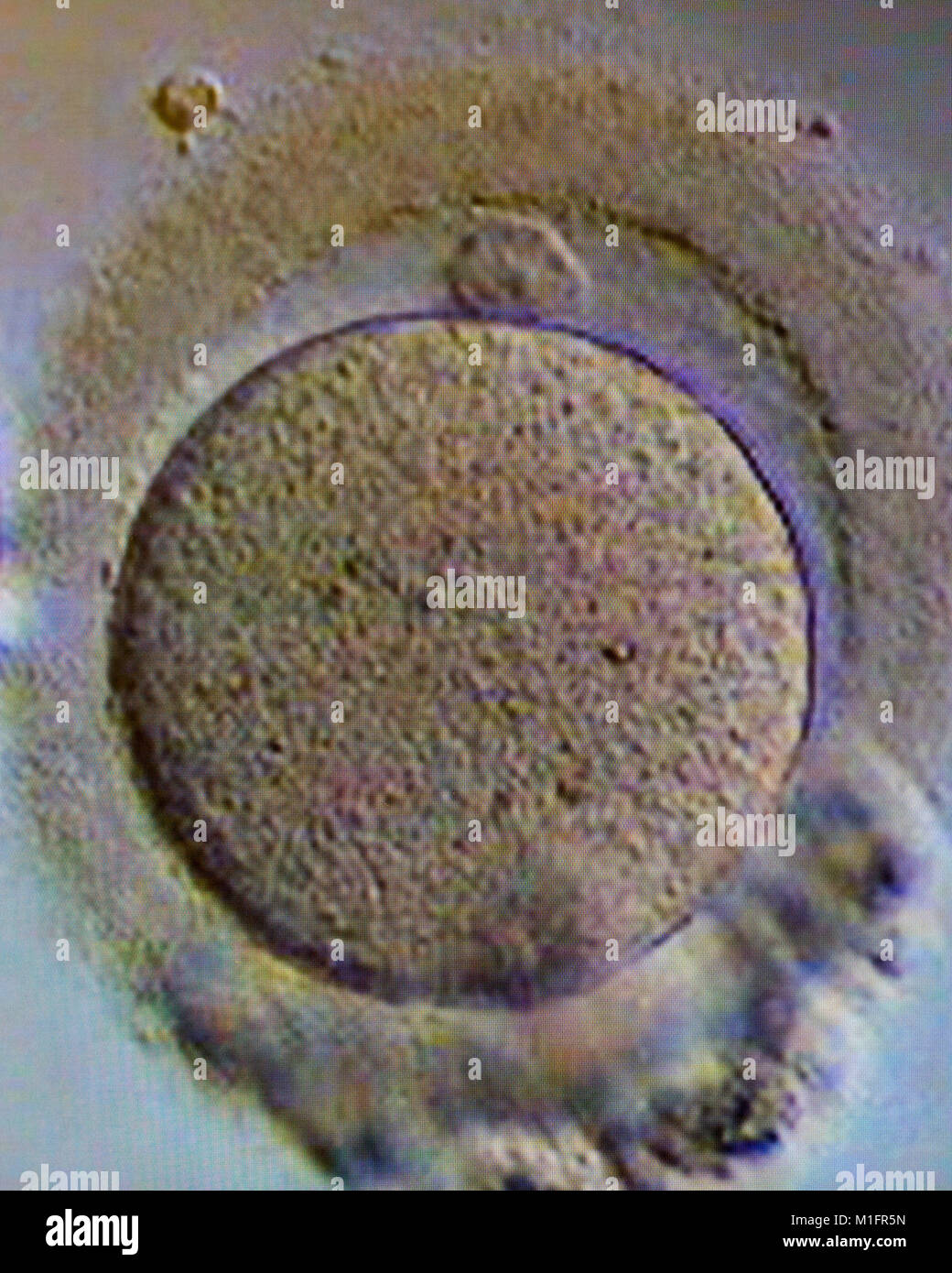 A monitor showing an egg cell at the fertility centre in Magdeburg ...
