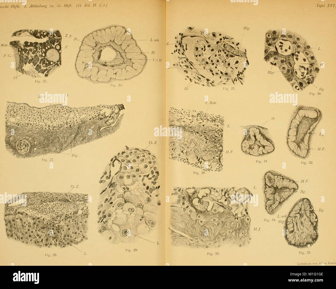 'Anatomische Hefte' is a 1899 scientific journal focused on human ...