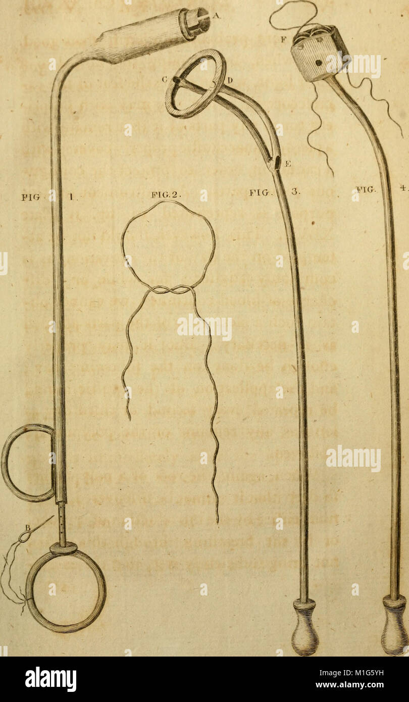 *A System of Surgery* (1787) outlines the principles and practices of ...