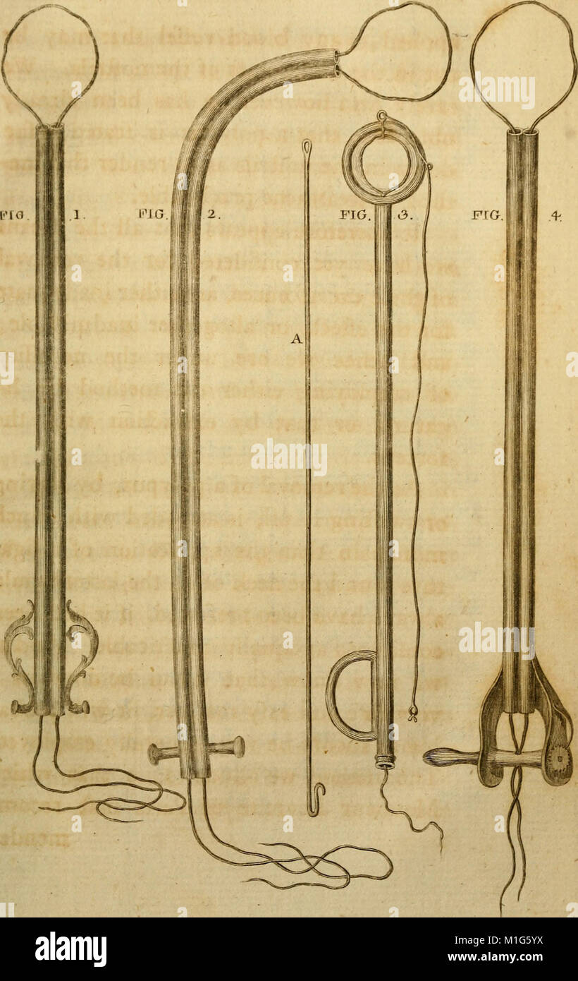 Evolution of surgical techniques hi-res stock photography and images ...