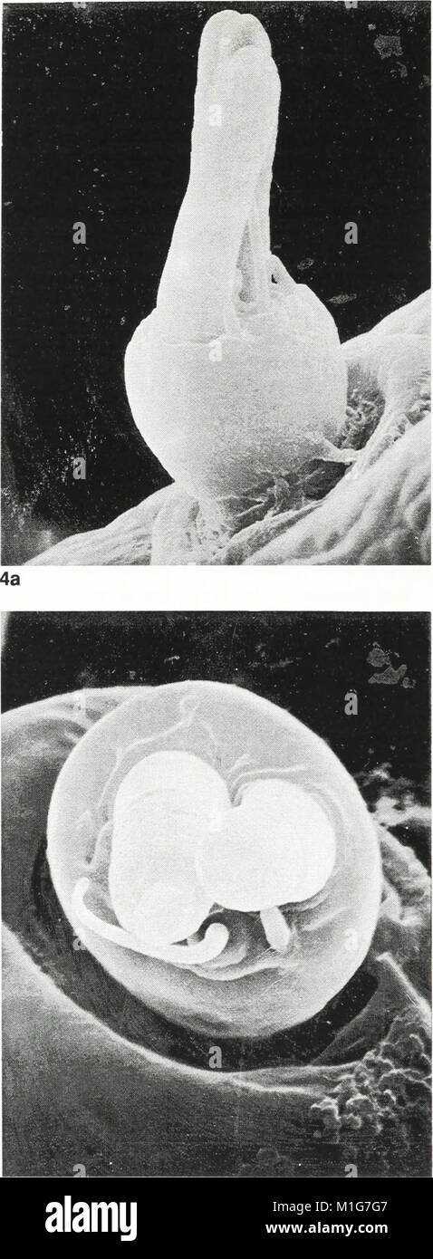 Morphological analysis hi-res stock photography and images - Alamy