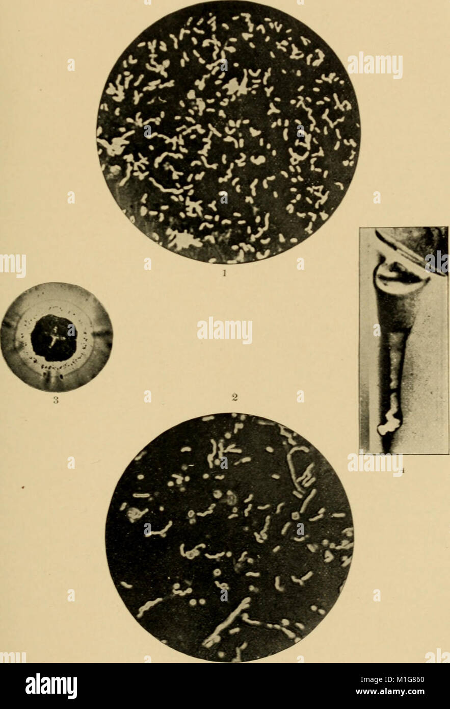 This 1895 text provides a comprehensive guide to childhood diseases ...