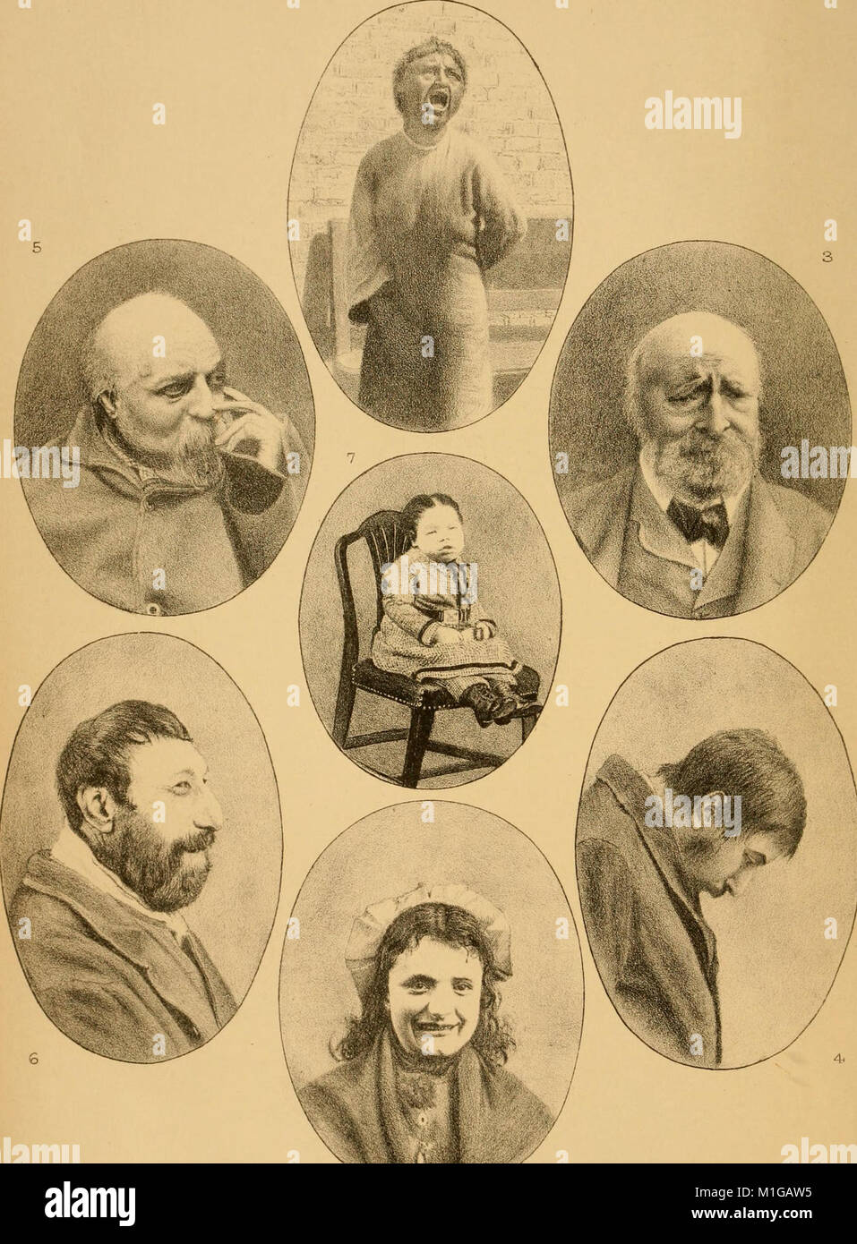 A Dictionary of psychological medicine giving the definition, etymology ...