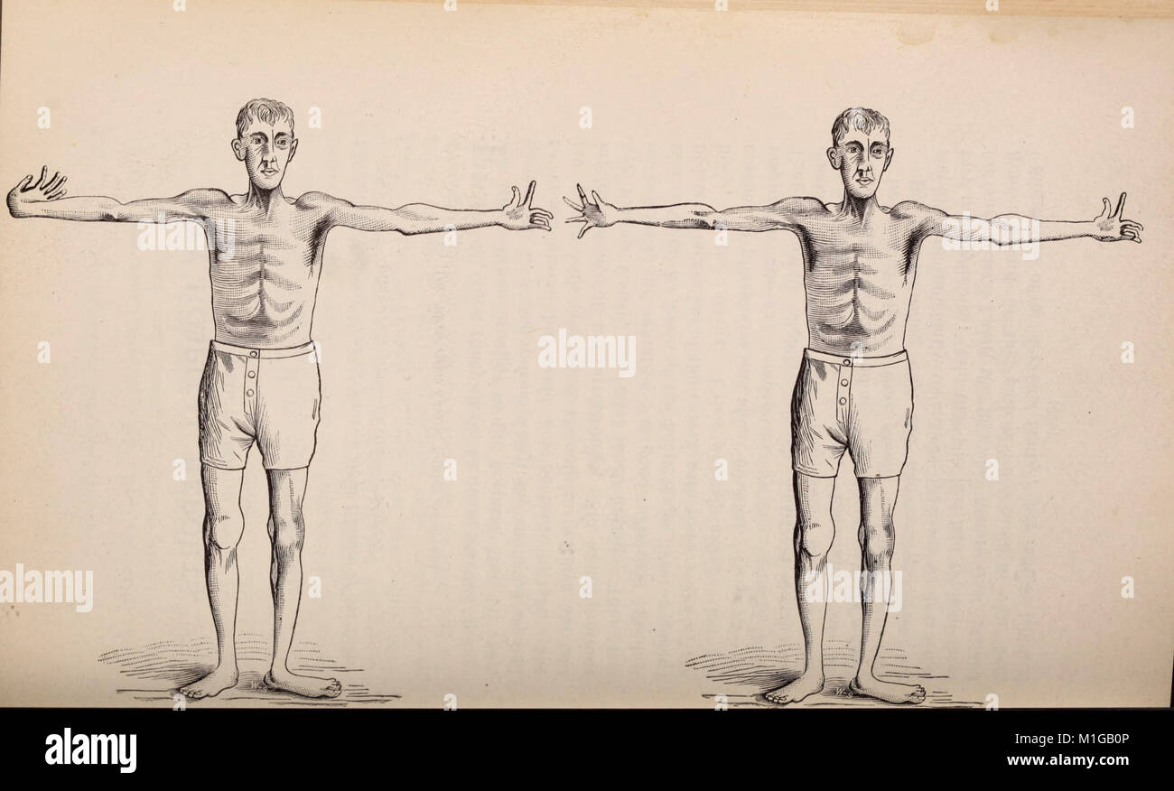 Alienist and neurologist. (1887) (14590761740 Stock Photo - Alamy