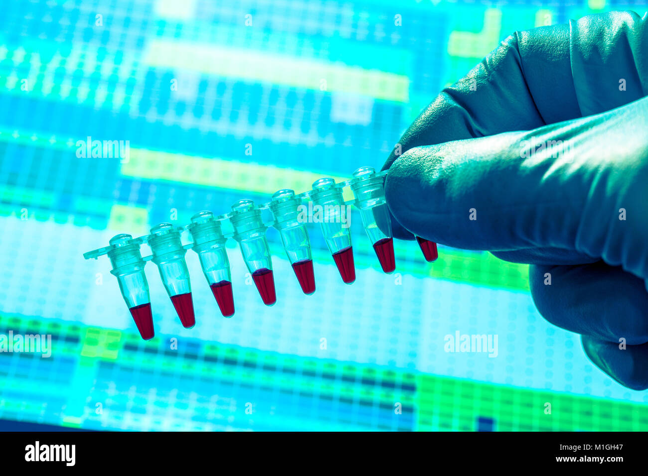 Bio samples for genetic analysis Blood In tube for laboratory analysis ...
