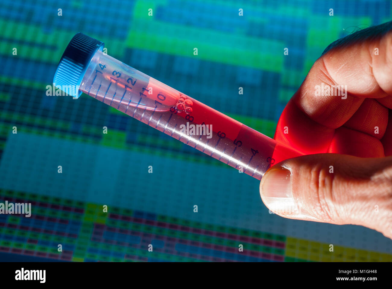 Bio samples for genetic analysis Blood In tube for laboratory analysis ...