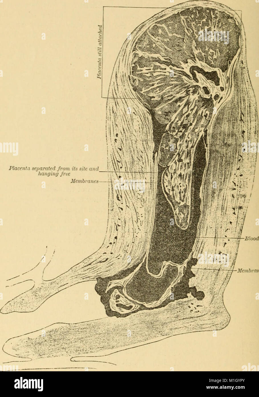 A system of obstetrics (1888) (14776758174 Stock Photo - Alamy