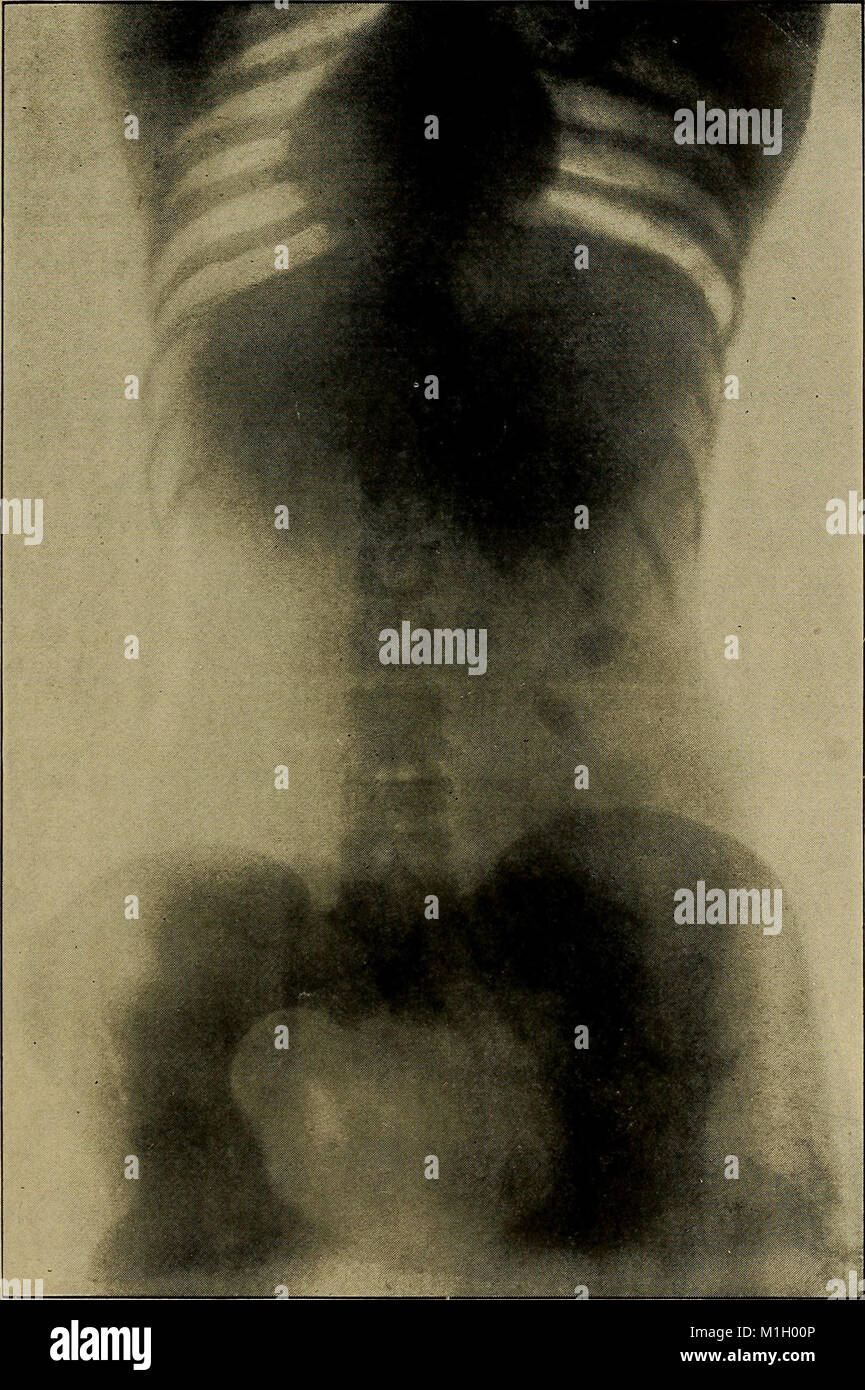 This educational system presents a guide to X-ray methods and medical ...