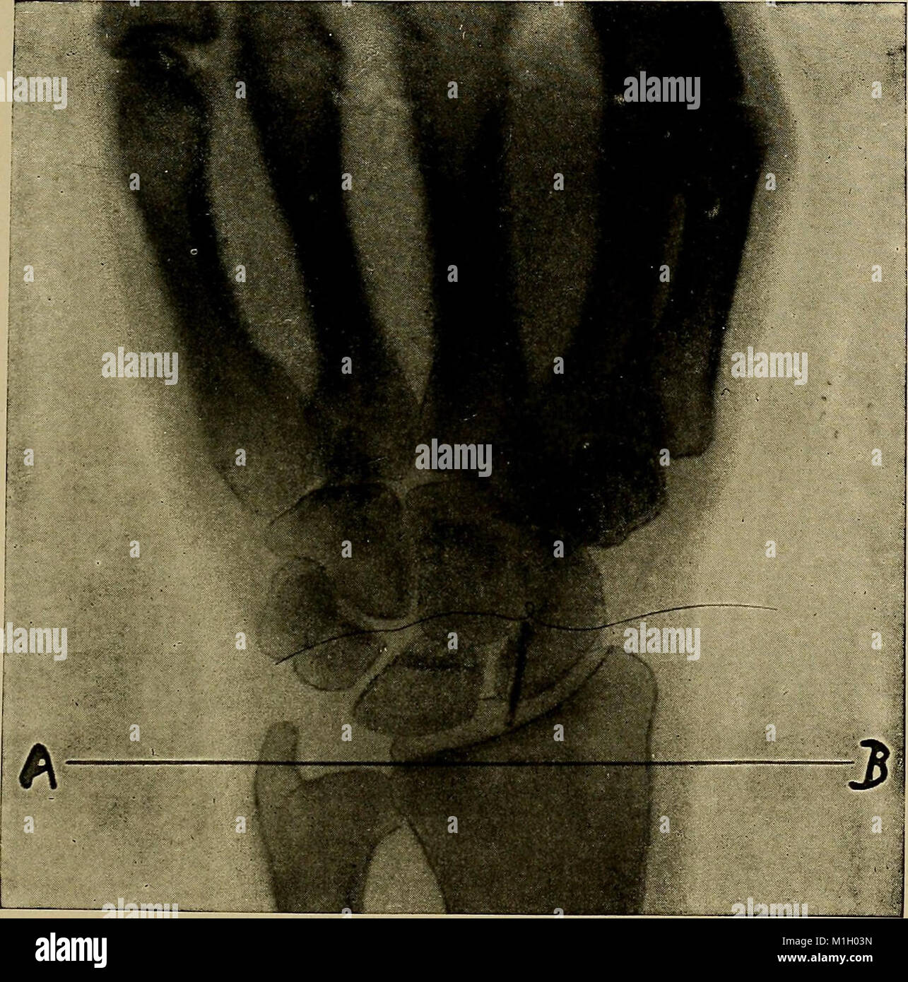 A system of instruction in X-ray methods and medical uses of light, hot ...