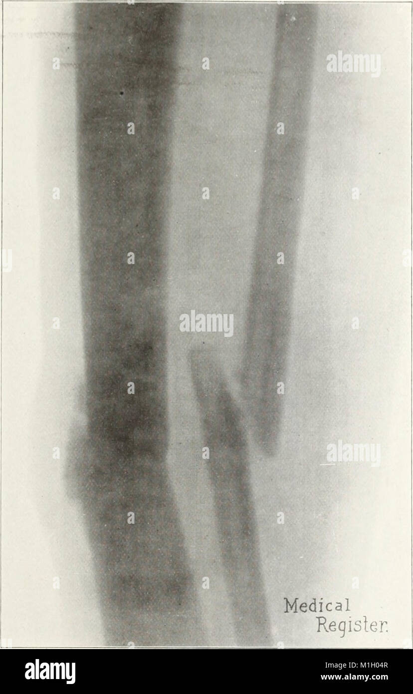 The American X-ray Journal (1897) presents early research and ...