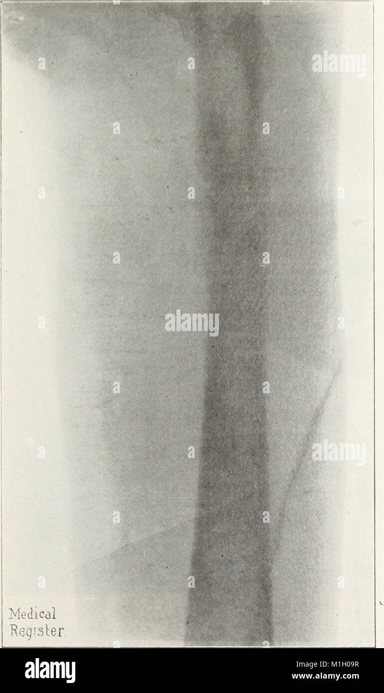 Journal radiology case no hi-res stock photography and images - Alamy