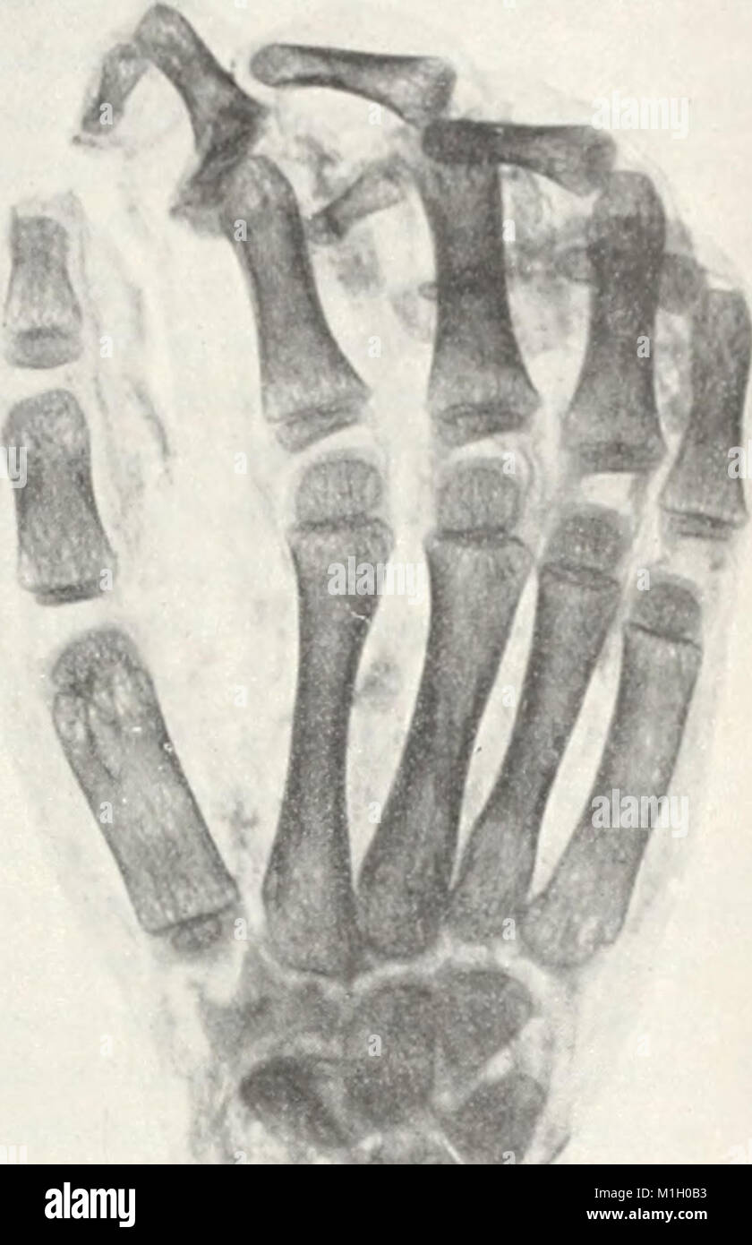 X ray in 19th century hi-res stock photography and images - Alamy