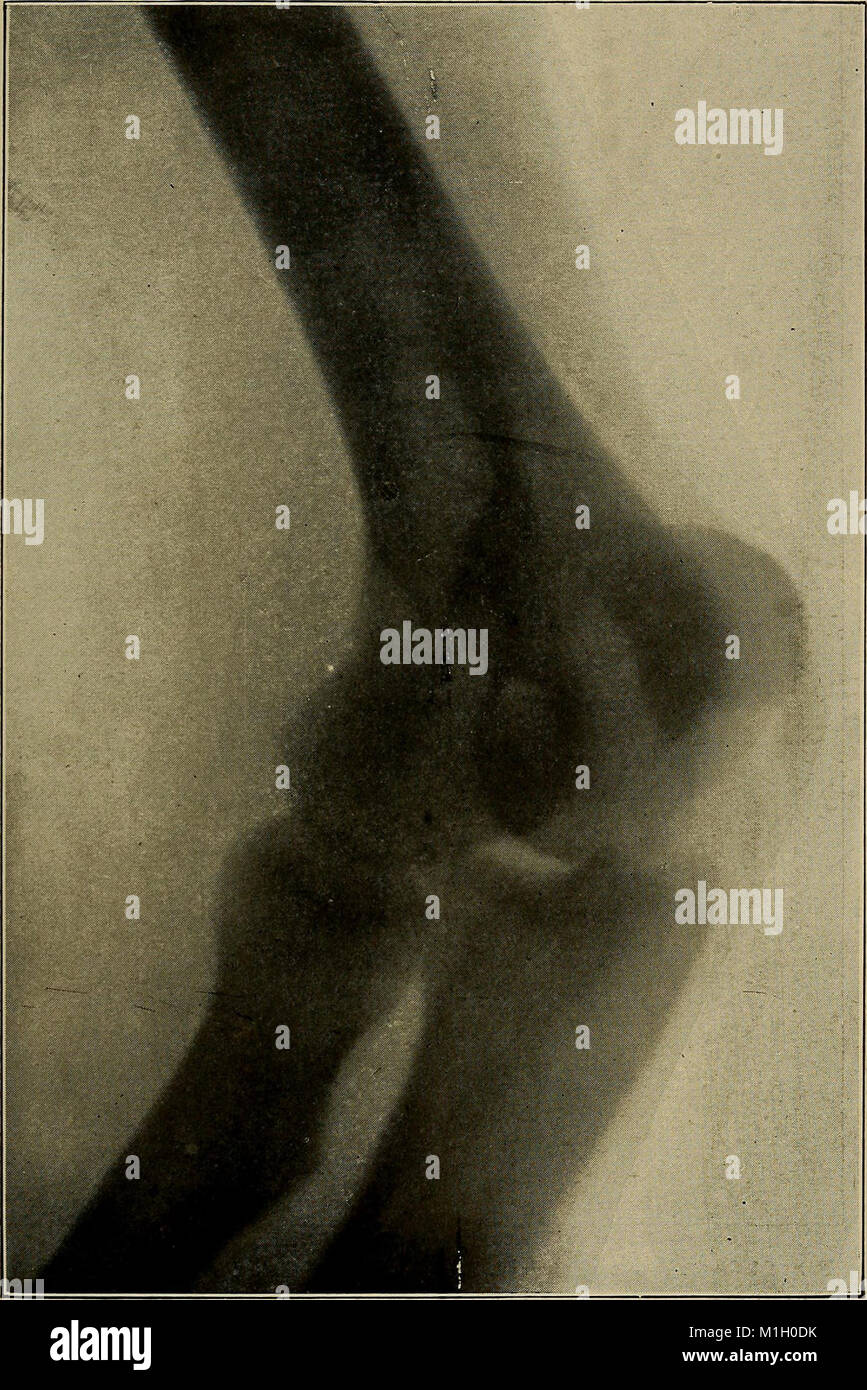 This instructional guide provides a system for learning X-ray ...