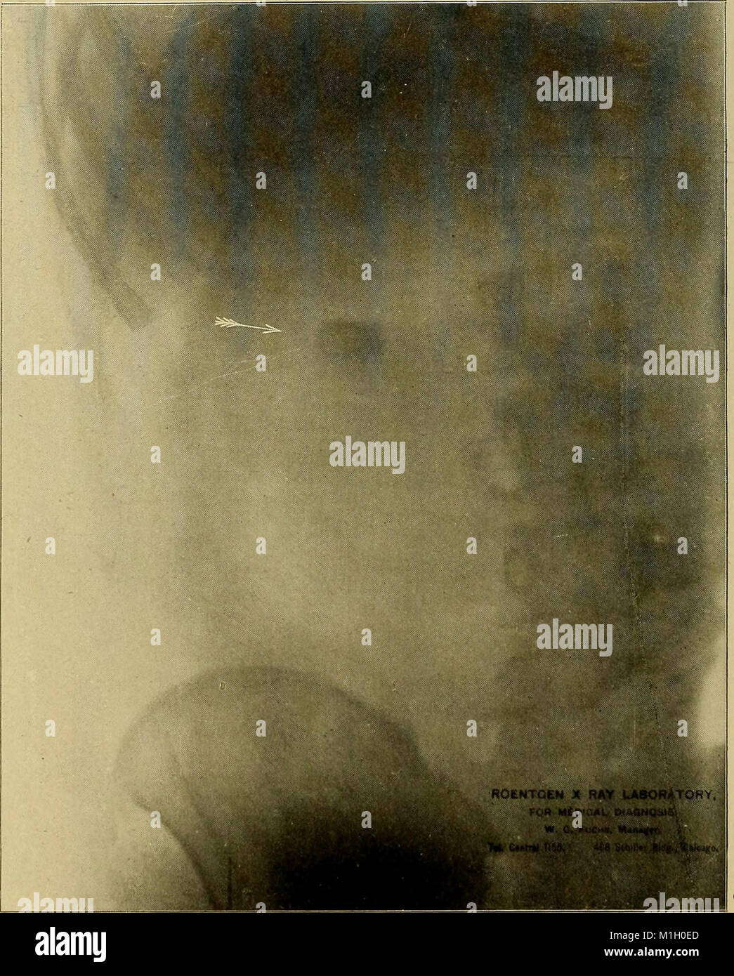 This system of instruction provides a guide to X-ray methods, light ...